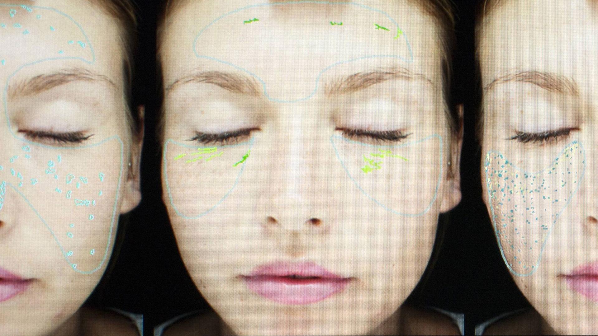 Narbenbildung - Neue Erkennisse zur Wundheilung